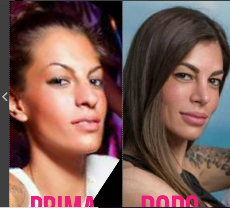 giada prima e dopo - Ultime Notizie Flash