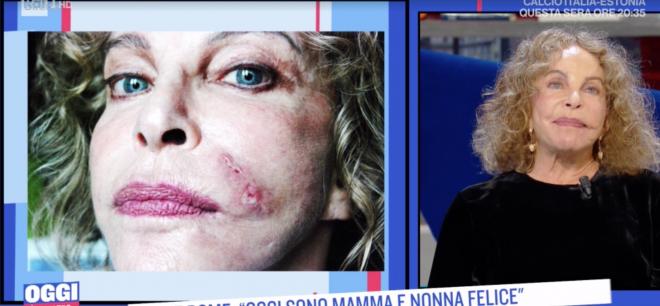 sydne - Ultime Notizie Flash