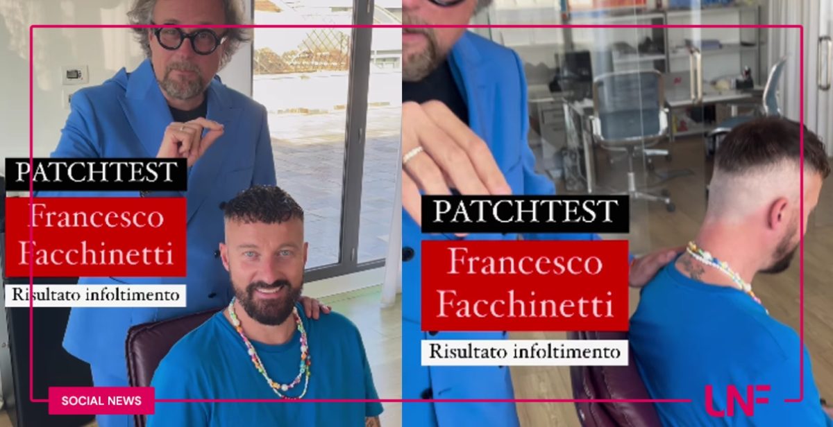 10 mila euro buttati: dopo il trapianto fallito, Facchinetti ci riprova ...