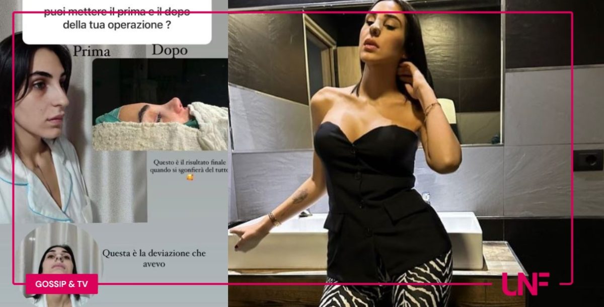 Gabriela Chieffo prima e dopo Temptation Island: filler, naso nuovo e seno nuovo - Ultime ...