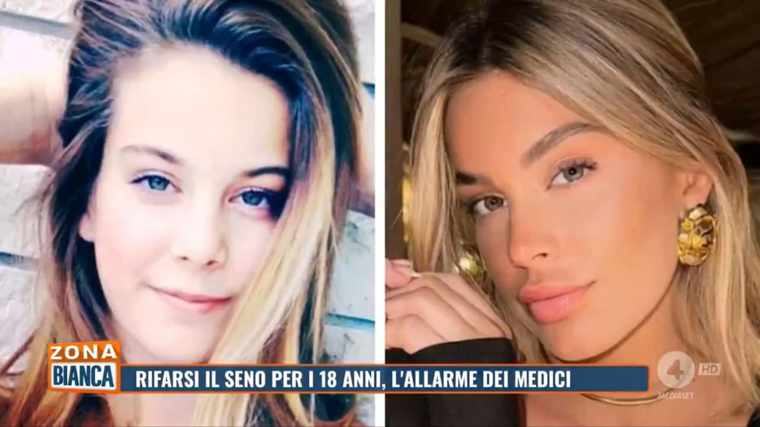 Sophie Codegoni i primi ritocchi a 16 anni oggi è pentita: prima e dopo ...