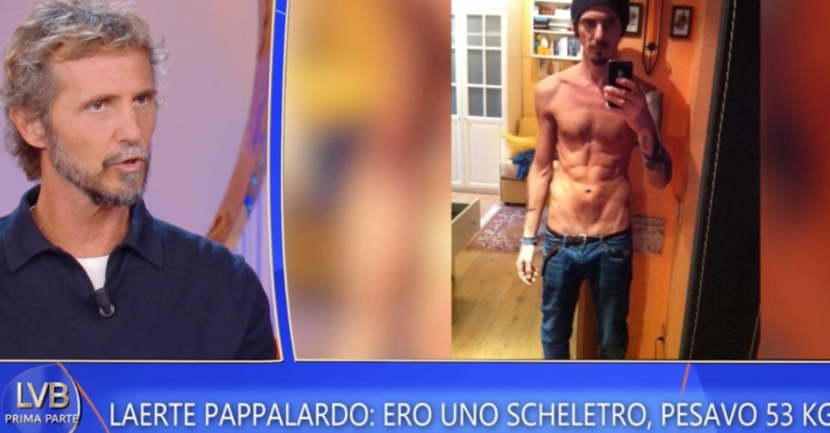 Laerte Pappalardo racconta dell'anoressia, di quanto era arrivato a ...
