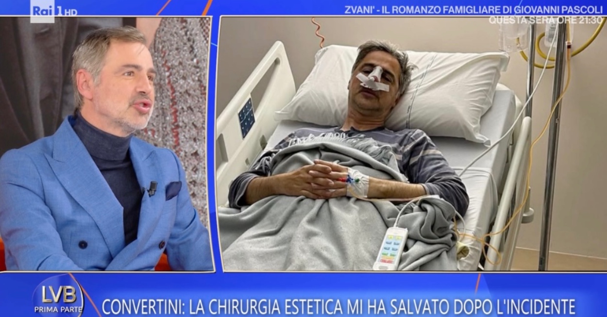 Beppe Convertini dopo l'incidente salvato dalla chirurgia estetica ...