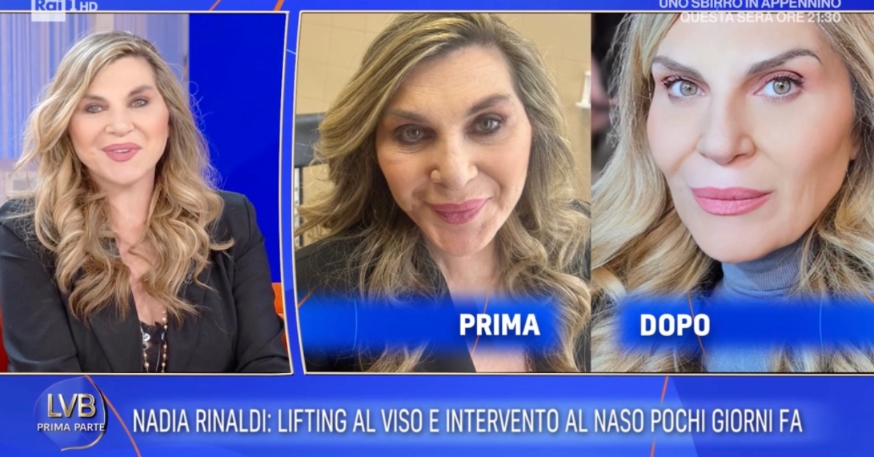 Nadia Rinaldi pochi giorni fa ha fatto il lifting al viso: ha davvero ...